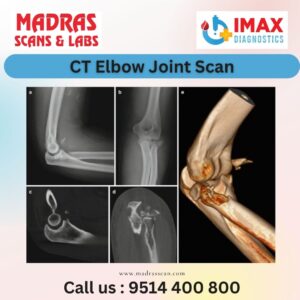 CT Scan For Elbow Joint - Madras Scans