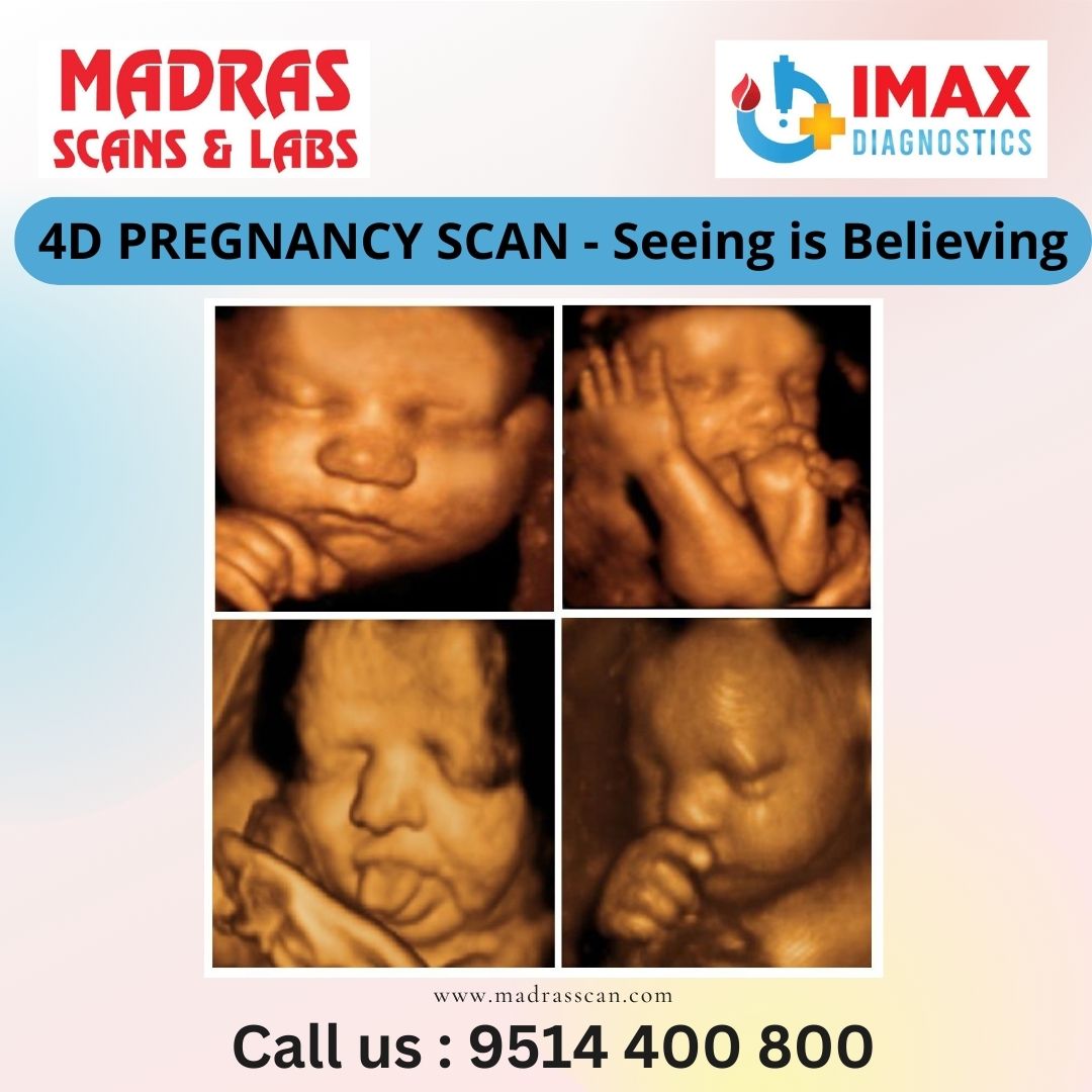 Benefits Of 4D Pregnancy Scans In Chennai - Madras Scans