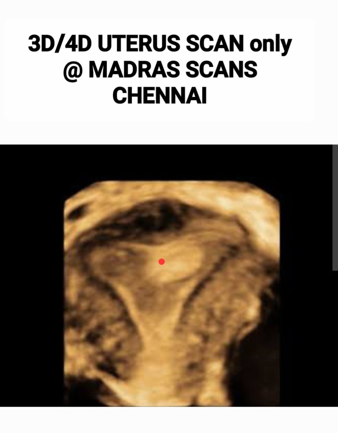 3D Pelvis Scan In Chennai - Madras Scans
