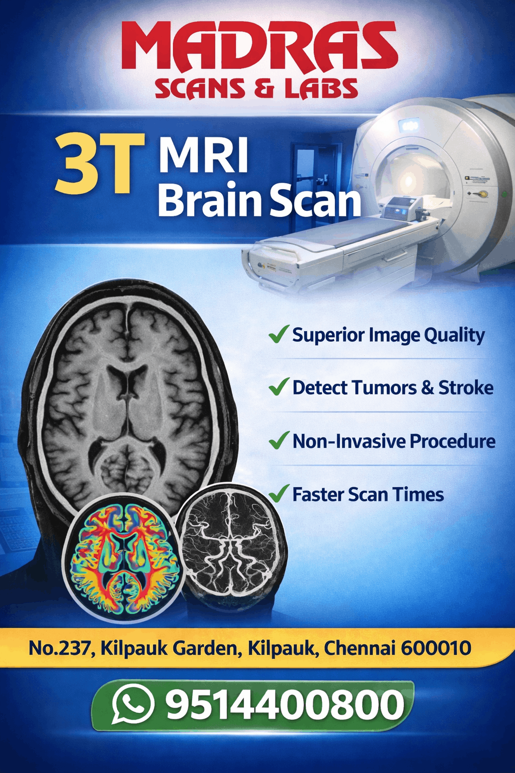 3T MRI Brain Uses - Madras Scans